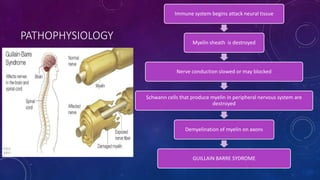Quadriparesis guillain barre syndrome ppt | PPTX