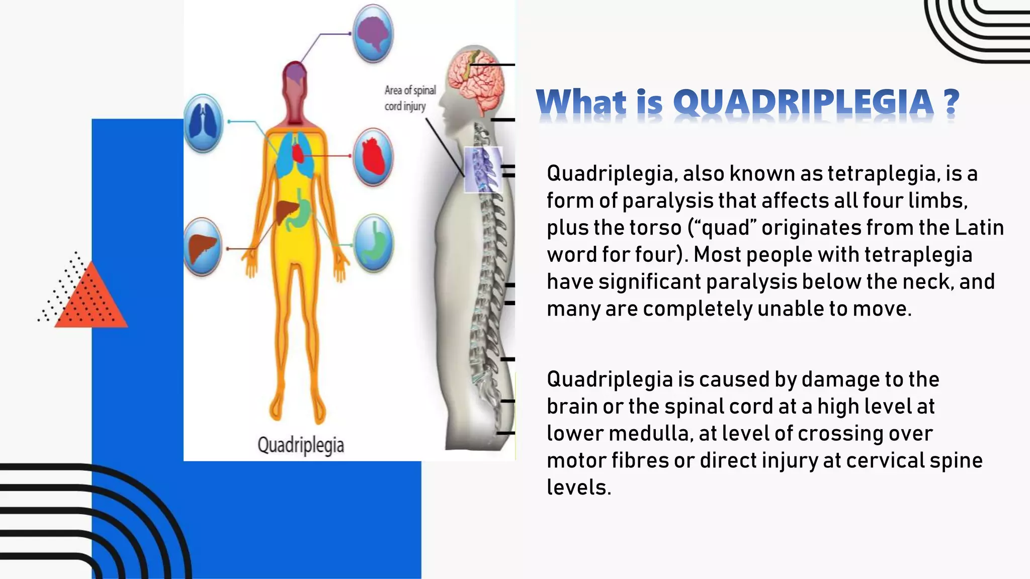 quadriplegia ppt fathimabi (1) 2.pptx