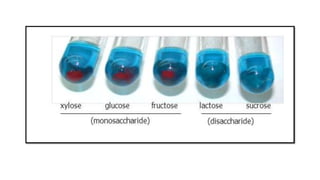 Qualitative analysis of carbohydrates | PPTX