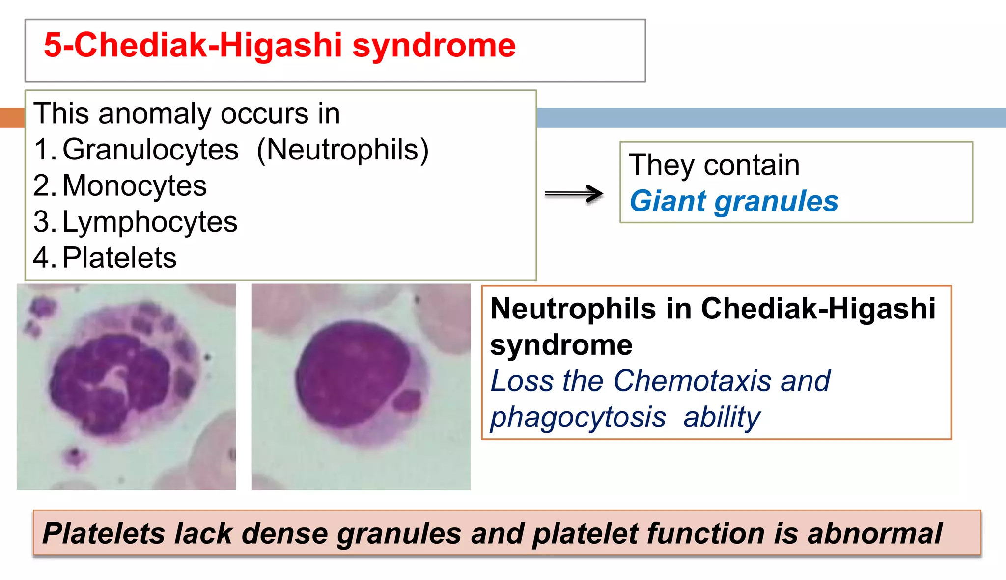 Qualitative defects of granular white cells.ppt