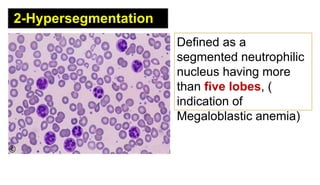 Qualitative defects of granular white cells.ppt