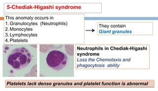 Qualitative defects of granular white cells.ppt