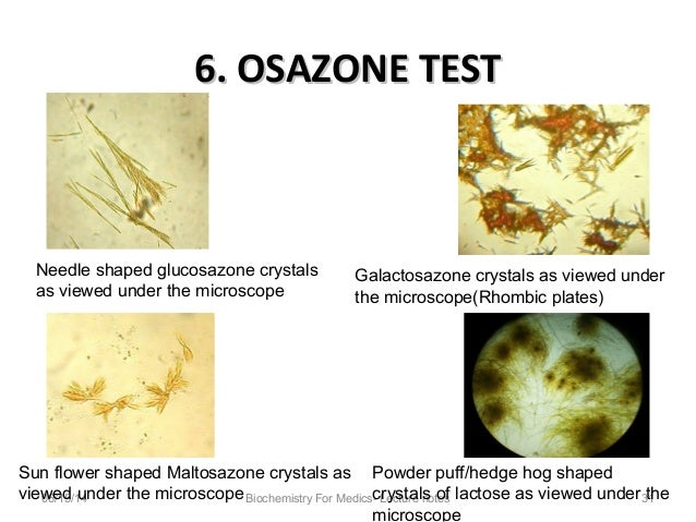 Qualitative tests for carbohydrates