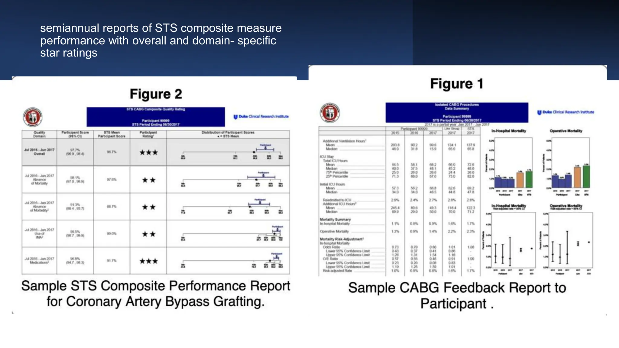 Quality Measurement in Cardiac Surgery | PPTX