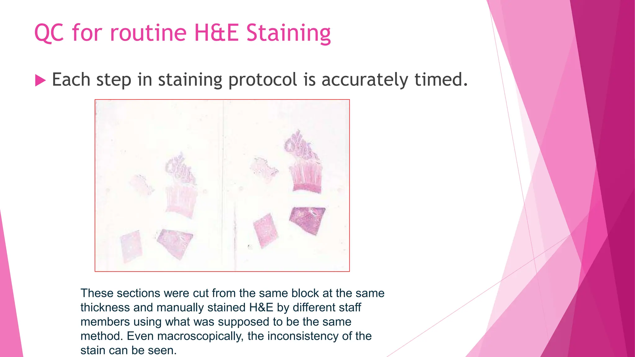 QUALITY CONTROL IN HISTOPATHOLOGY-MICROTOMY ,STAINING ,REPORTING.pptx