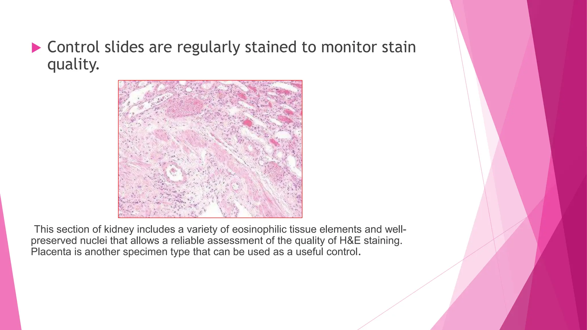 QUALITY CONTROL IN HISTOPATHOLOGY-MICROTOMY ,STAINING ,REPORTING.pptx | Blood Disorders ...