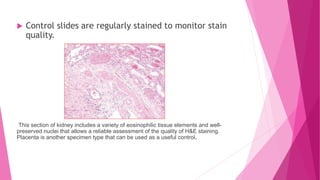 QUALITY CONTROL IN HISTOPATHOLOGY-MICROTOMY ,STAINING ,REPORTING.pptx