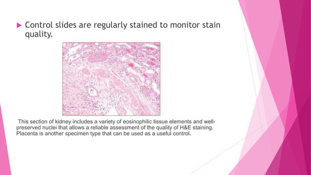 QUALITY CONTROL IN HISTOPATHOLOGY-MICROTOMY ,STAINING ,REPORTING.pptx | Blood Disorders ...