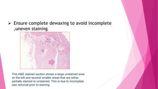 QUALITY CONTROL IN HISTOPATHOLOGY-MICROTOMY ,STAINING ,REPORTING.pptx