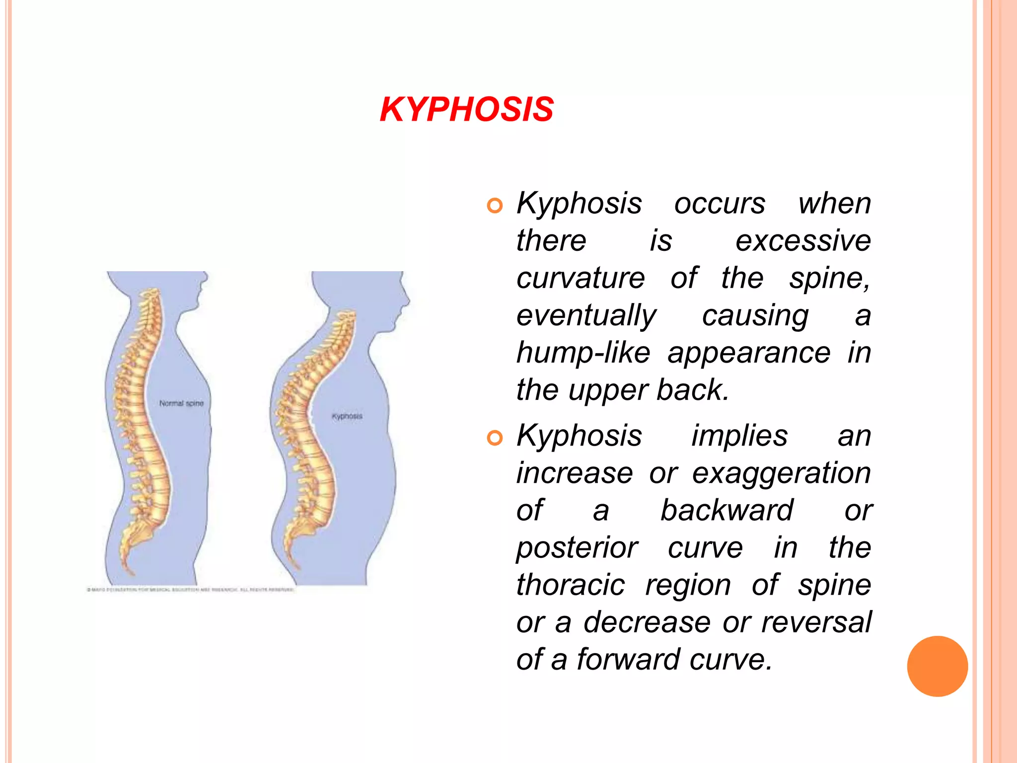 EFFECT OF EXERCISES ON POSTURAL DEFORMITIES AND QUALITY OF LIFE | PPTX