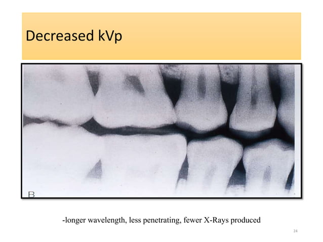 CHAPTER-7 - QUALITY OF X-RAY BEAM | PPTX | Physics | Science