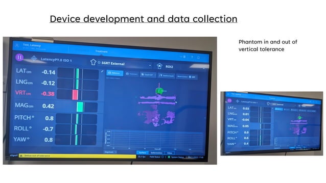 Quantification of beam latency using AlignRT | PDF