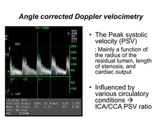Quantification of ica stenosis(정혜선) 20110331 | PPT