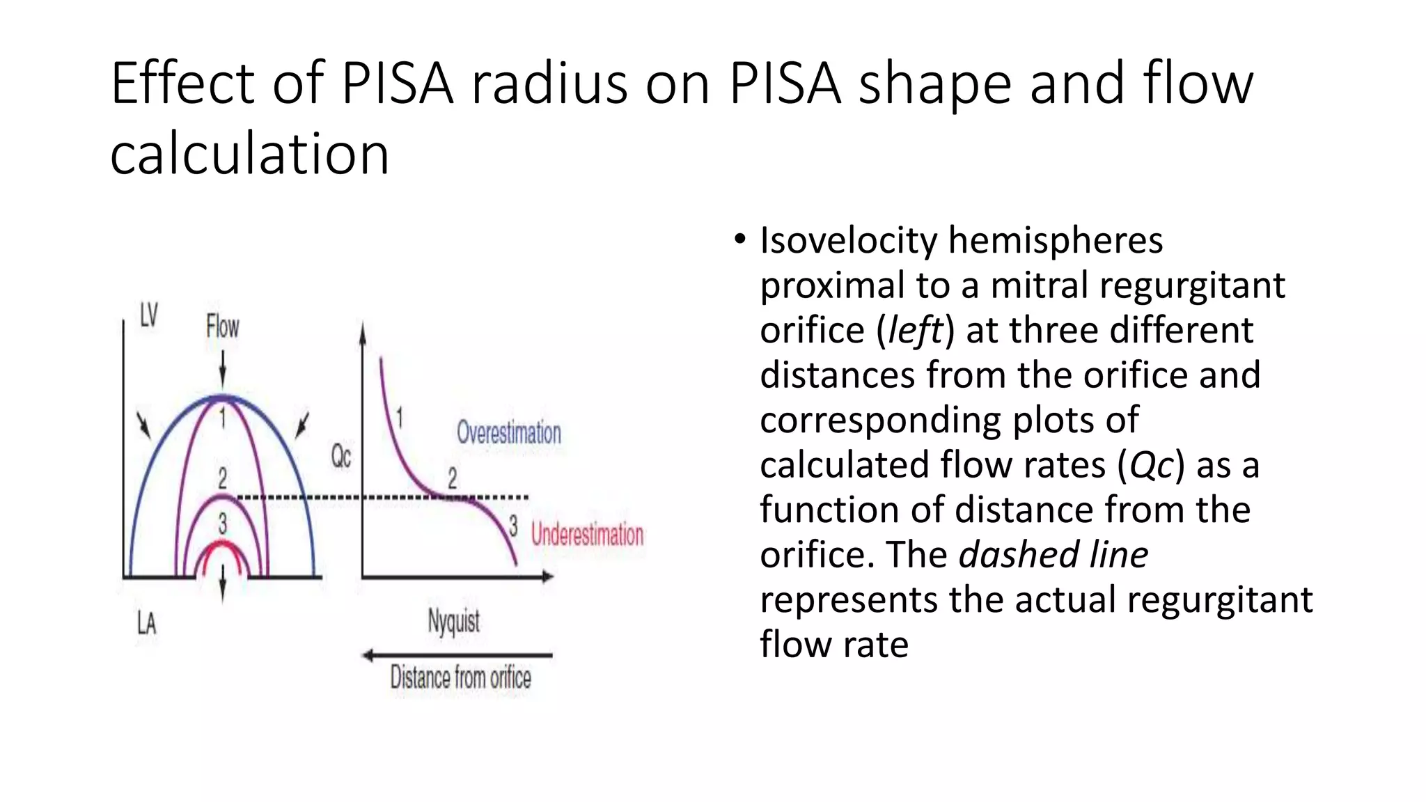 Quantification of mitral regurgitation by PISA | PPTX