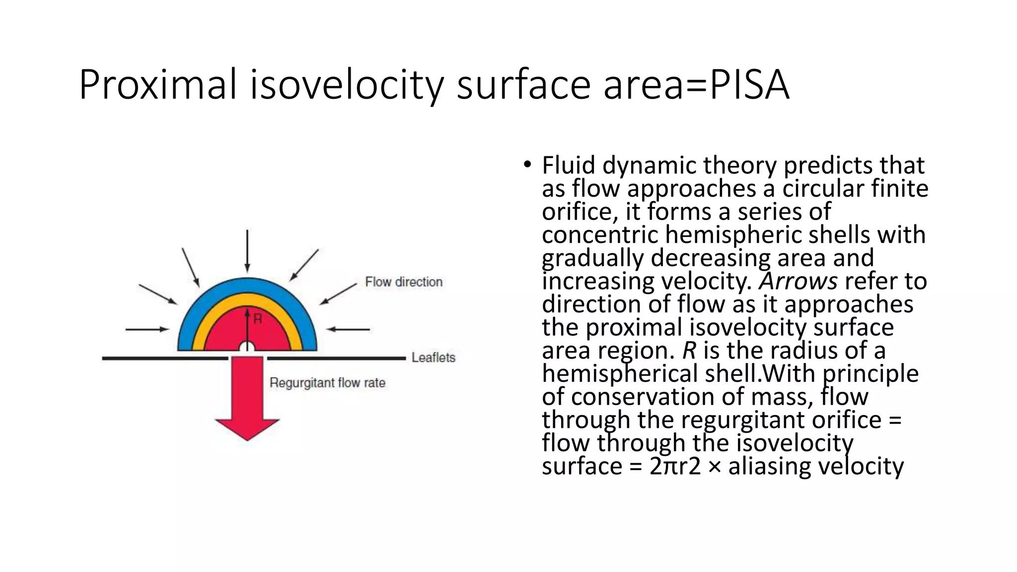 Quantification of mitral regurgitation by PISA | PPTX