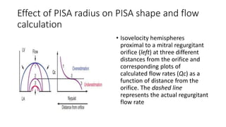 Quantification of mitral regurgitation by PISA | PPTX