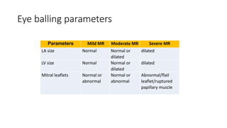 Quantification of mitral regurgitation by PISA | PPTX