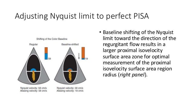 Quantification of mitral regurgitation by PISA