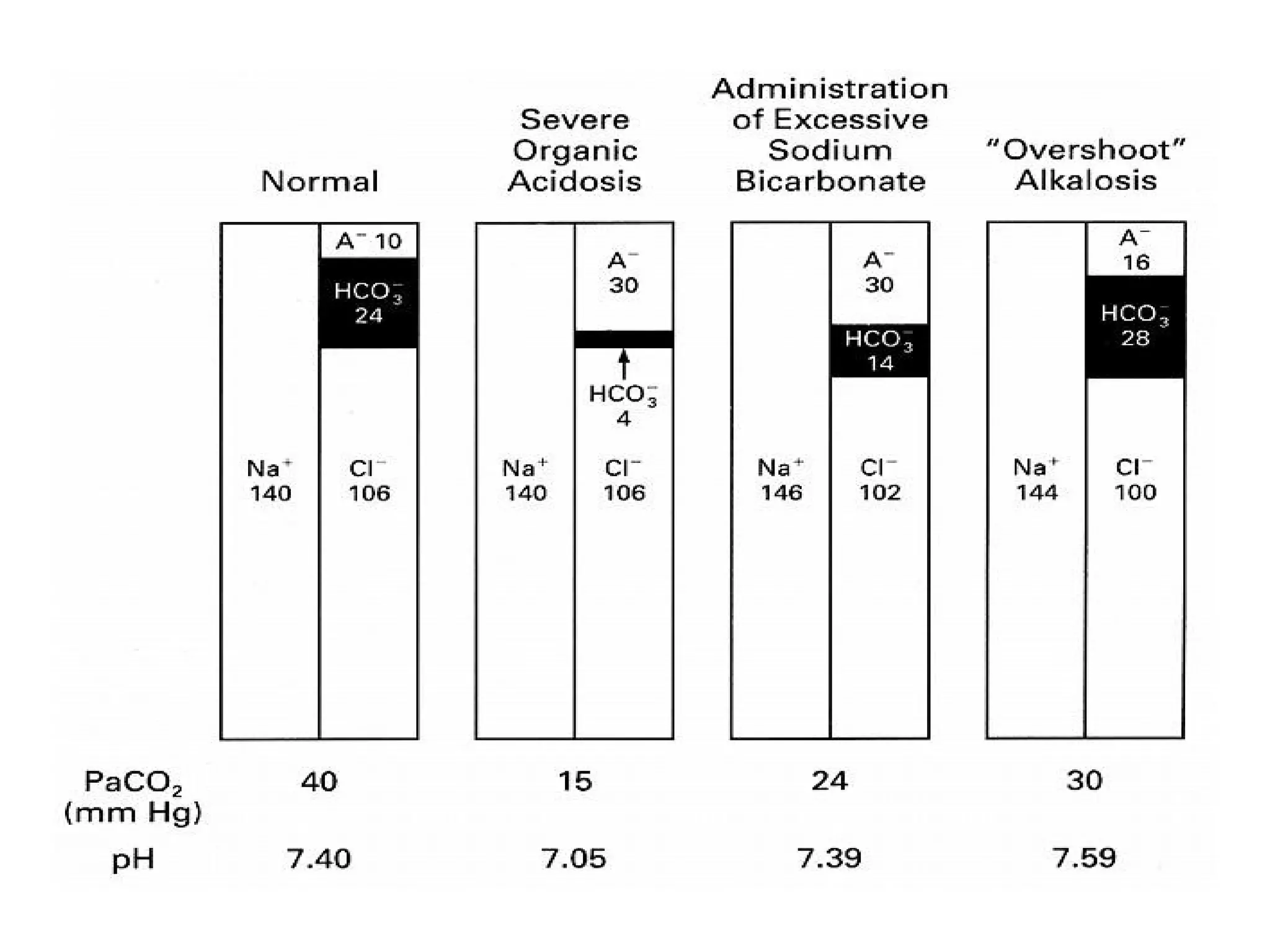 Quantitative Acid Base Analysis Fencl Stewart Approach | PPT
