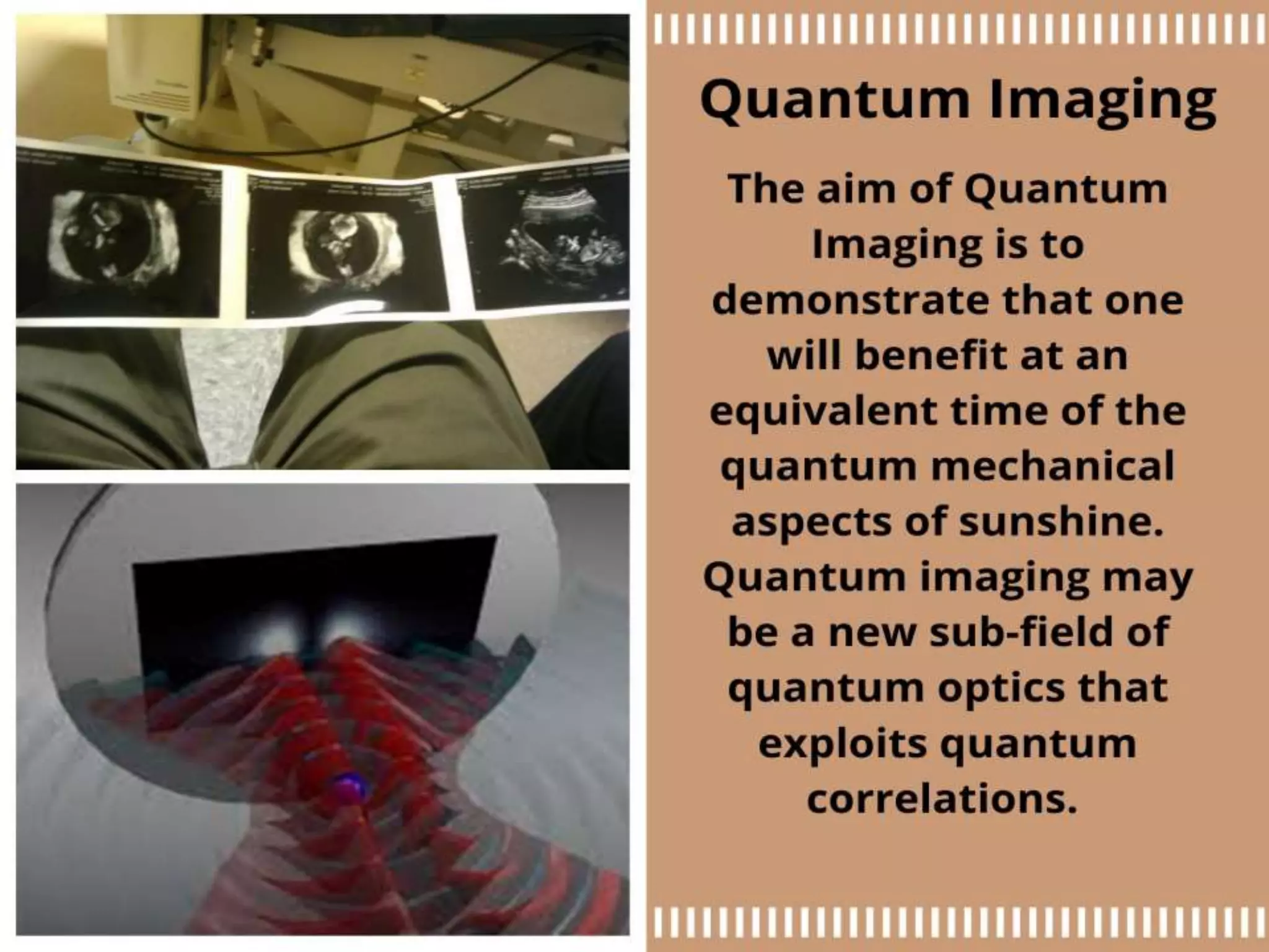 Quantum imaging - Toronto East X-Ray & Ultrasound | PPT