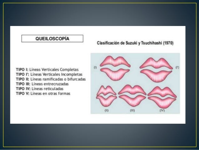 Queiloscopia y Rugoscopia ODONTOLOGIA FORENSE