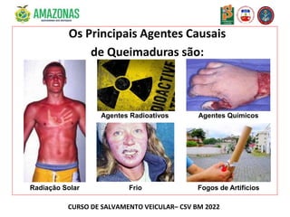 Queimaduras.pptx