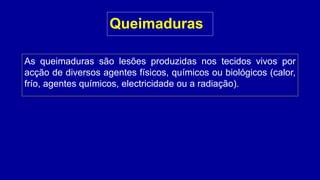Queimaduras.pptx