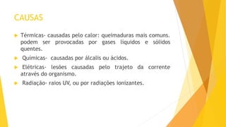 QUEIMADURAS | PPT