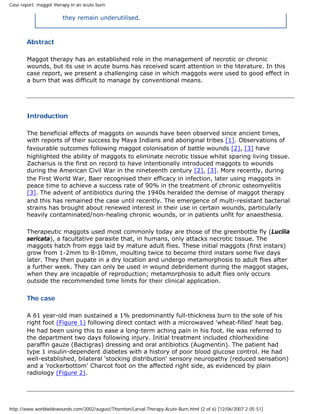 Quemadura aguda | PDF