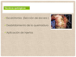 Quemaduras | PPTX | Skin and Dermatology | Diseases and Conditions