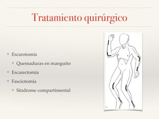 Quemaduras | PDF