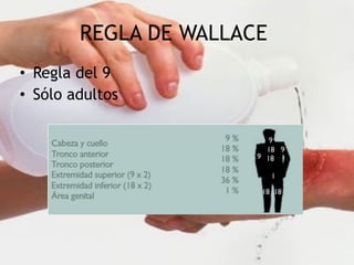 Quemaduras | PDF