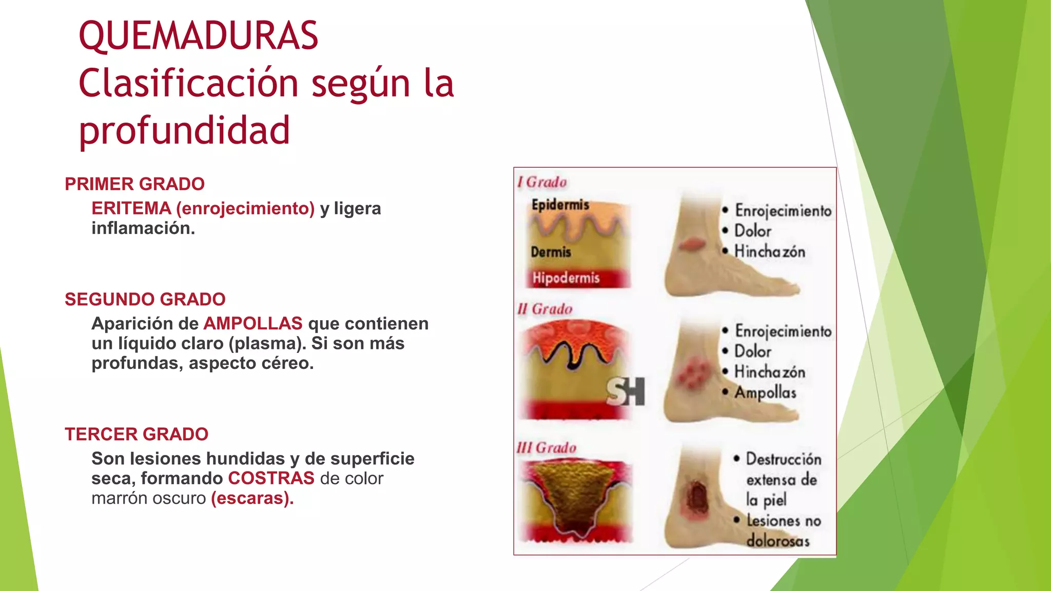 Quemaduras parte1 | PPTX