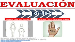 QUEMADURAS.pptx