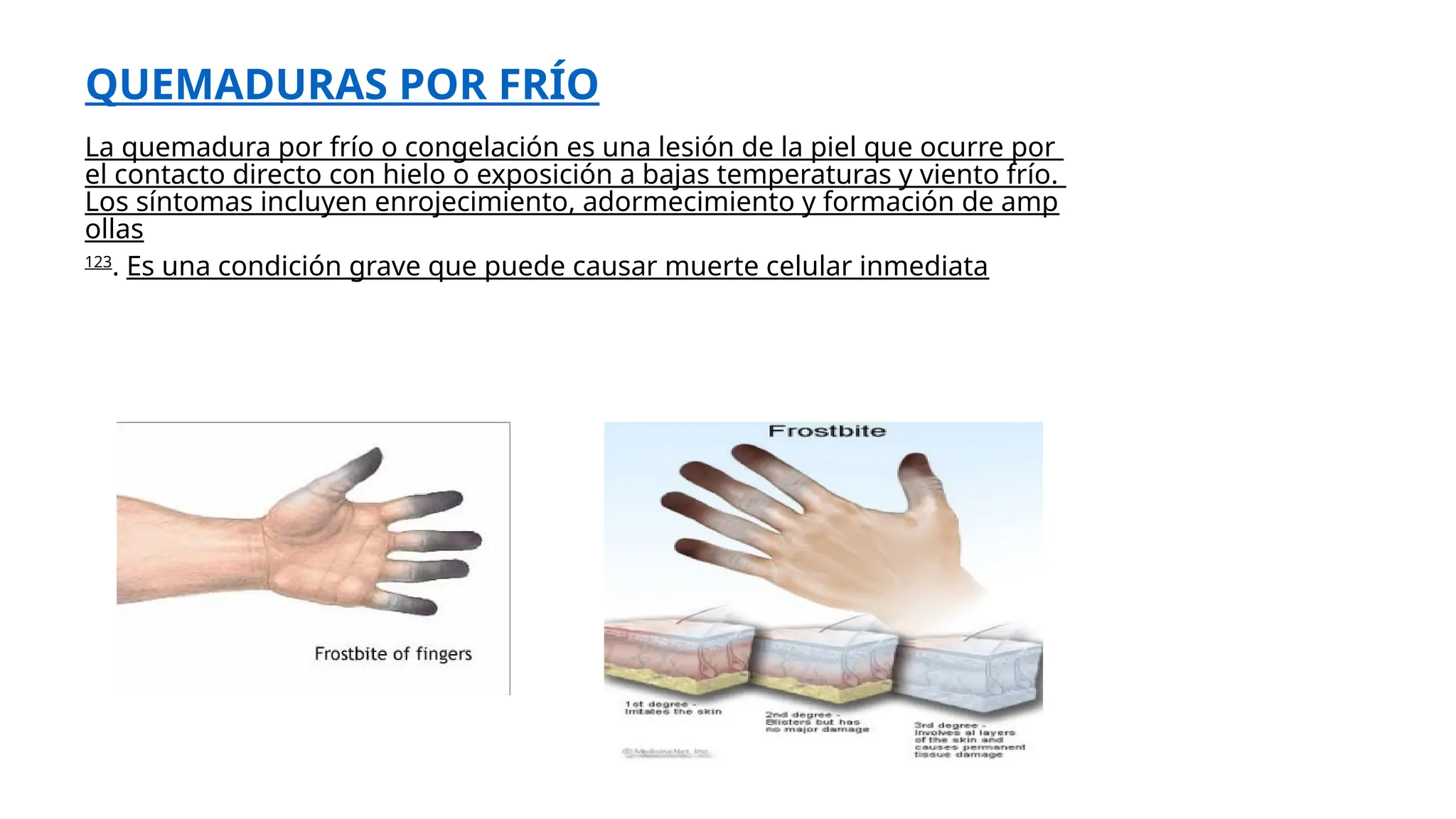 QUEMADURAS tipo de mas comunes para la practica clínica pptx | PPTX