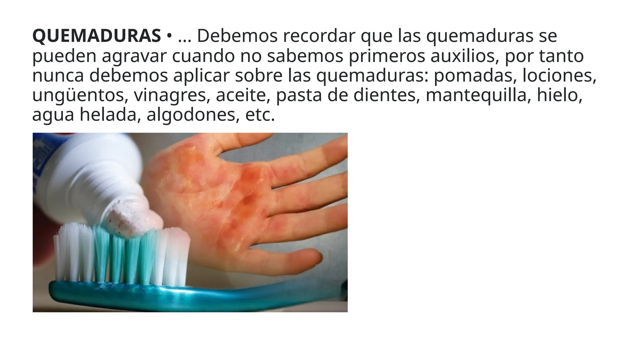 QUEMADURAS tipo de mas comunes para la practica clínica pptx | PPTX