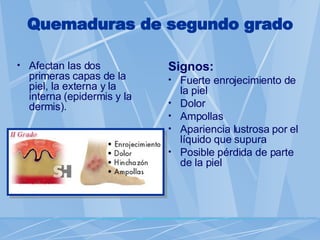 Quemaduras | PPS