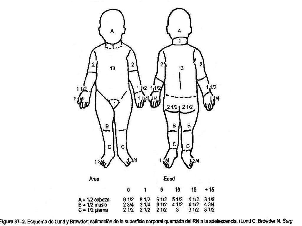 Quemaduras En Pediatra