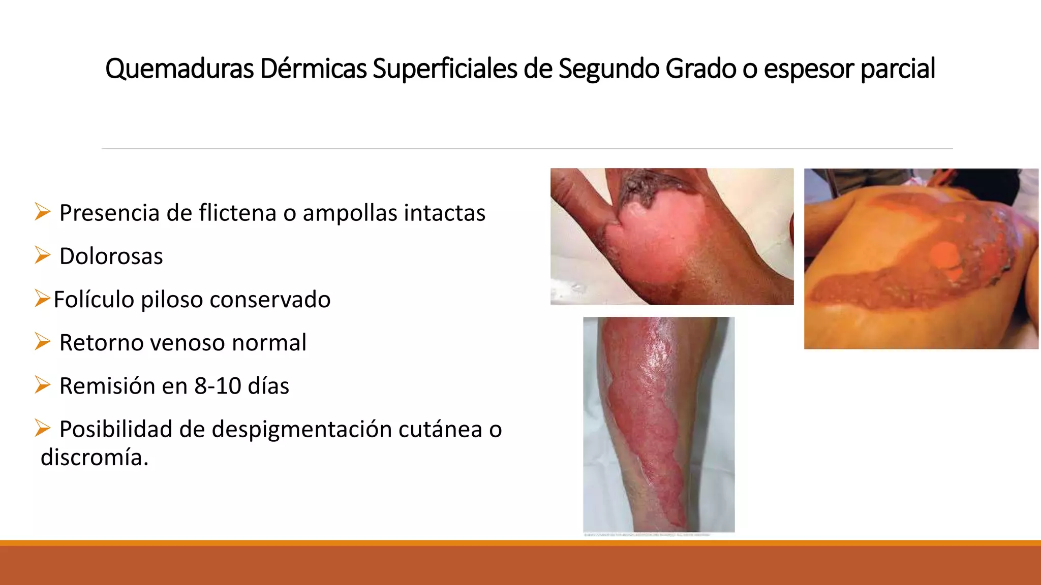 Quemaduras - Lesiones Térmicas | PPTX | First Aid | Injuries