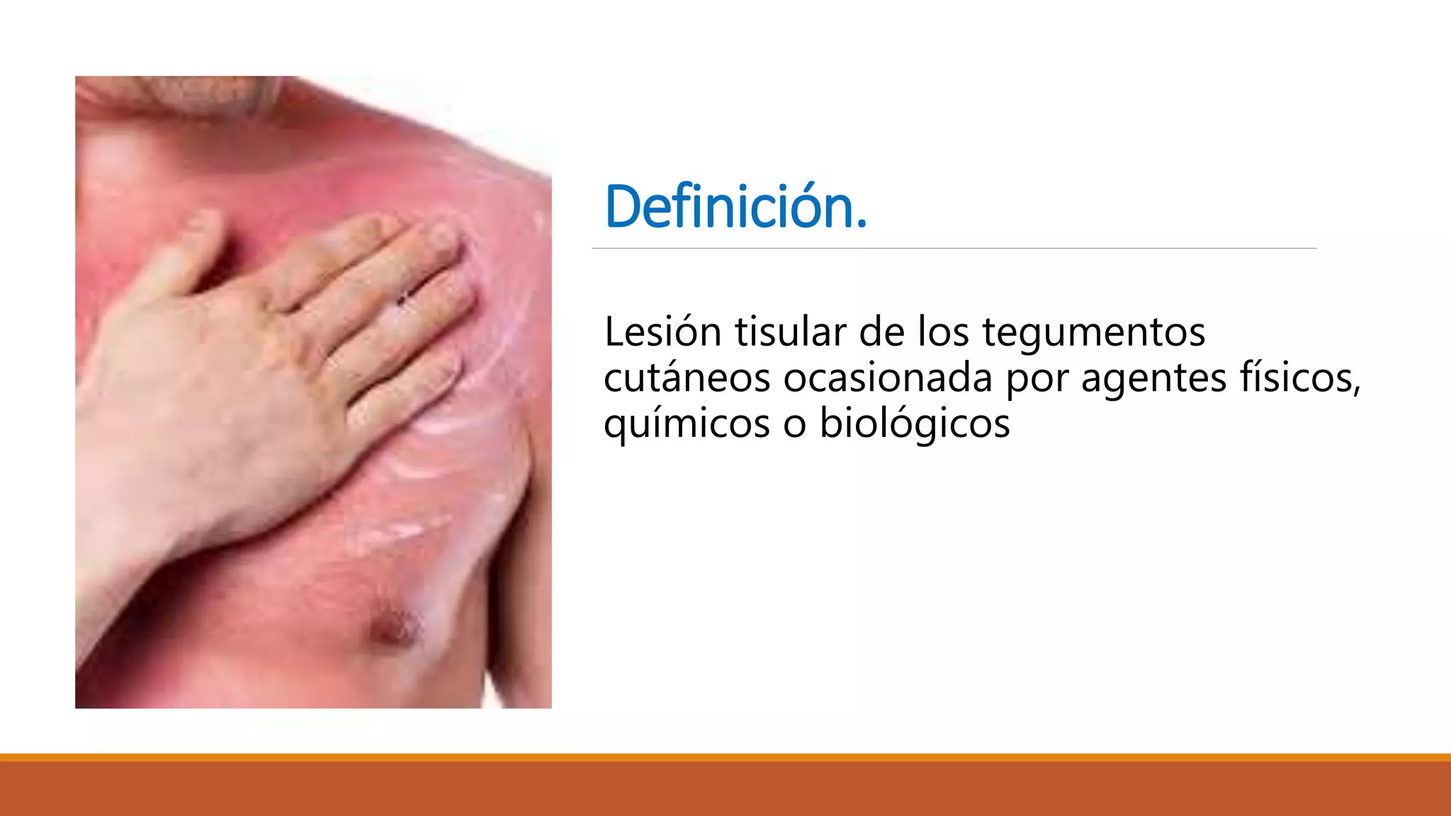 Quemaduras - Lesiones Térmicas | PPTX | First Aid | Injuries