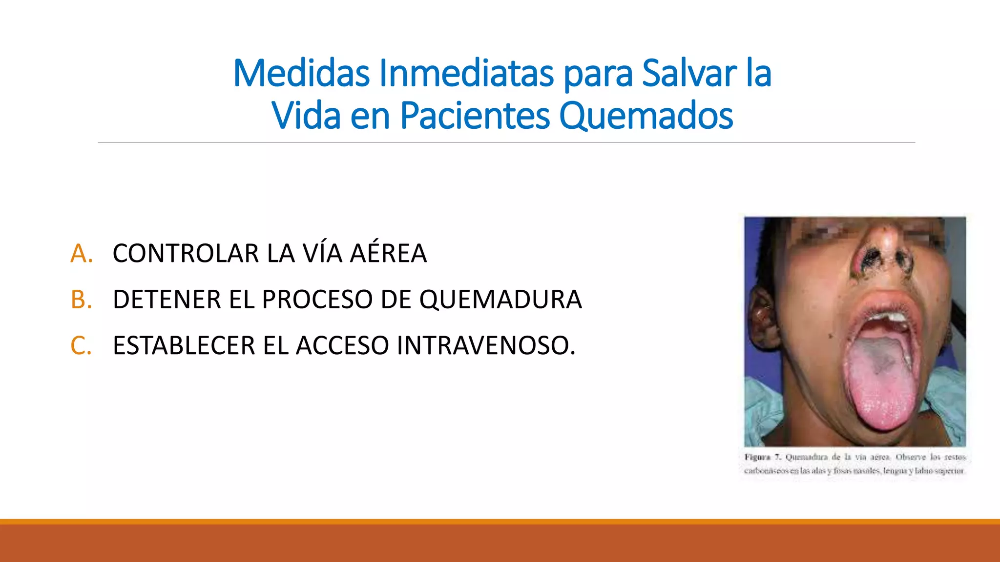 Quemaduras - Lesiones Térmicas | PPTX | First Aid | Injuries