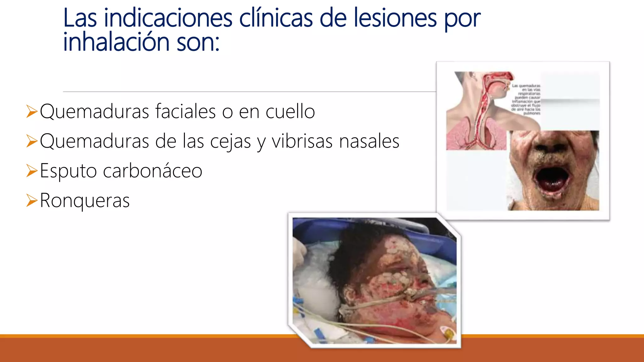Quemaduras - Lesiones Térmicas | PPTX | First Aid | Injuries