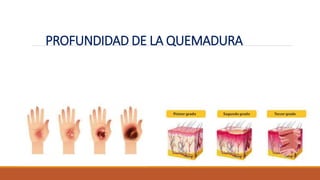 Quemaduras - Lesiones Térmicas | PPTX | First Aid | Injuries