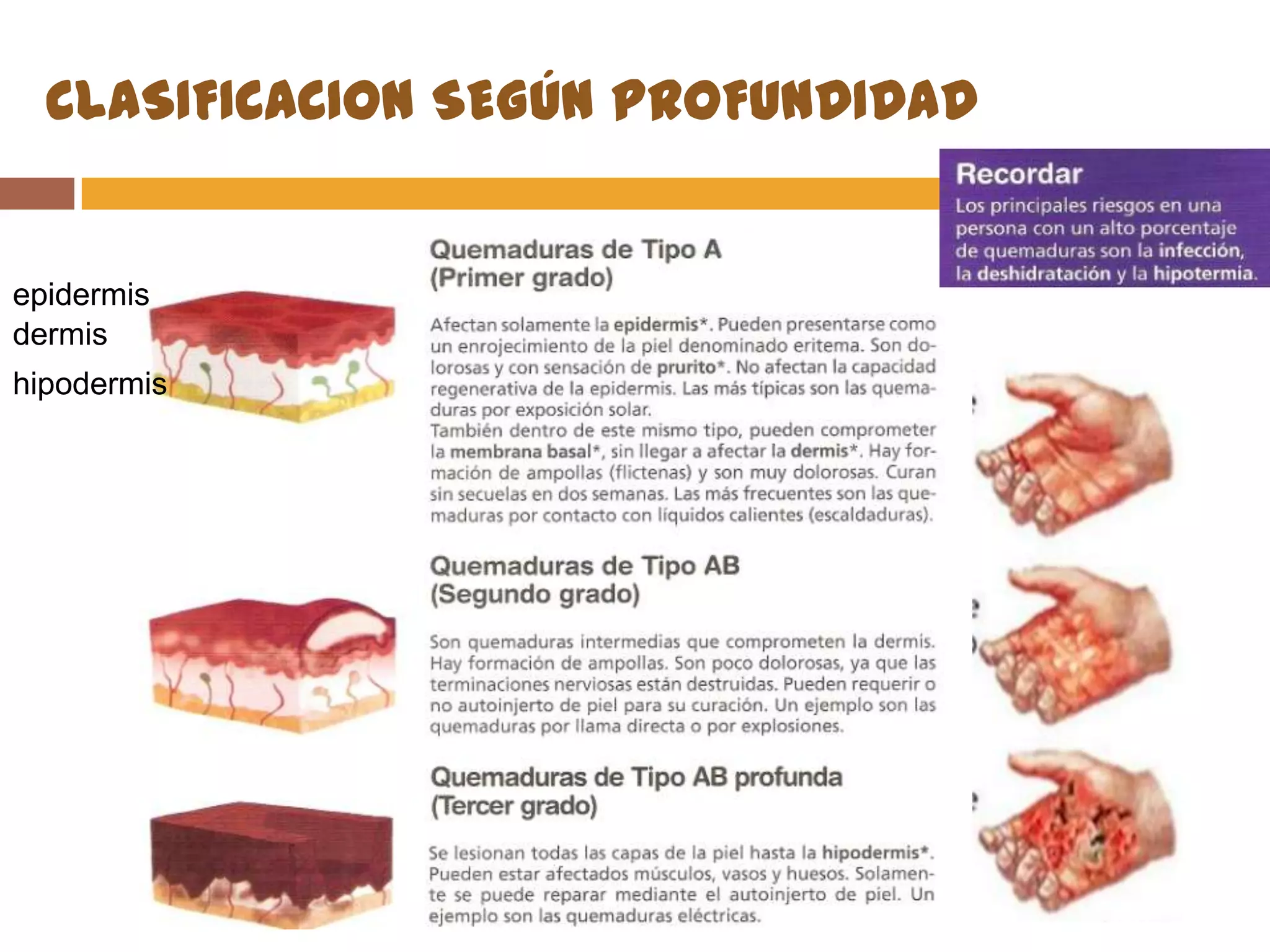 Quemaduras. qb | PPTX