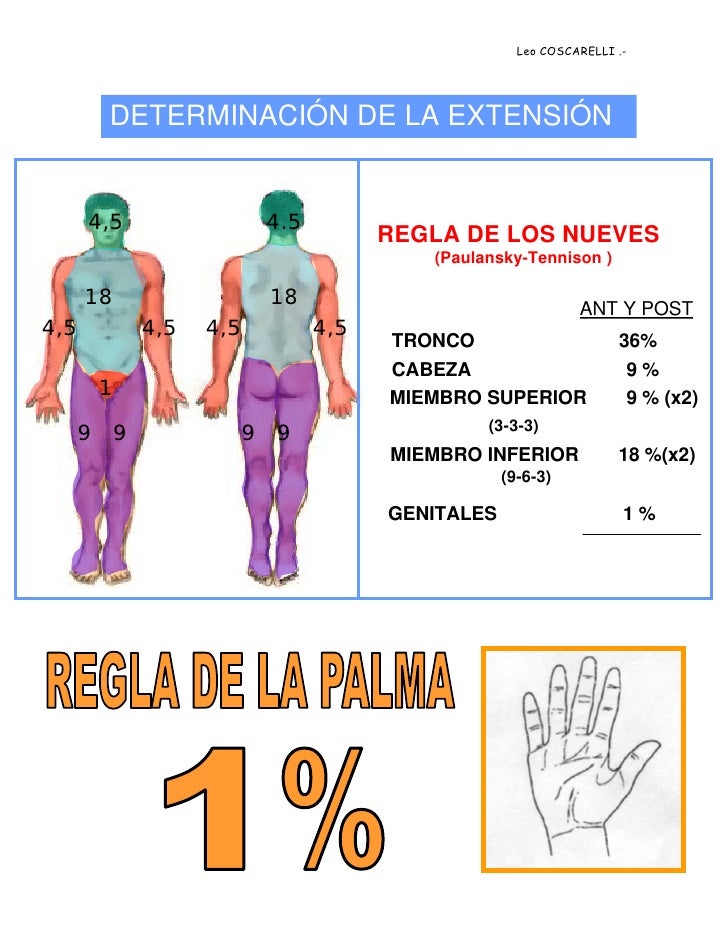 Quemaduras 2