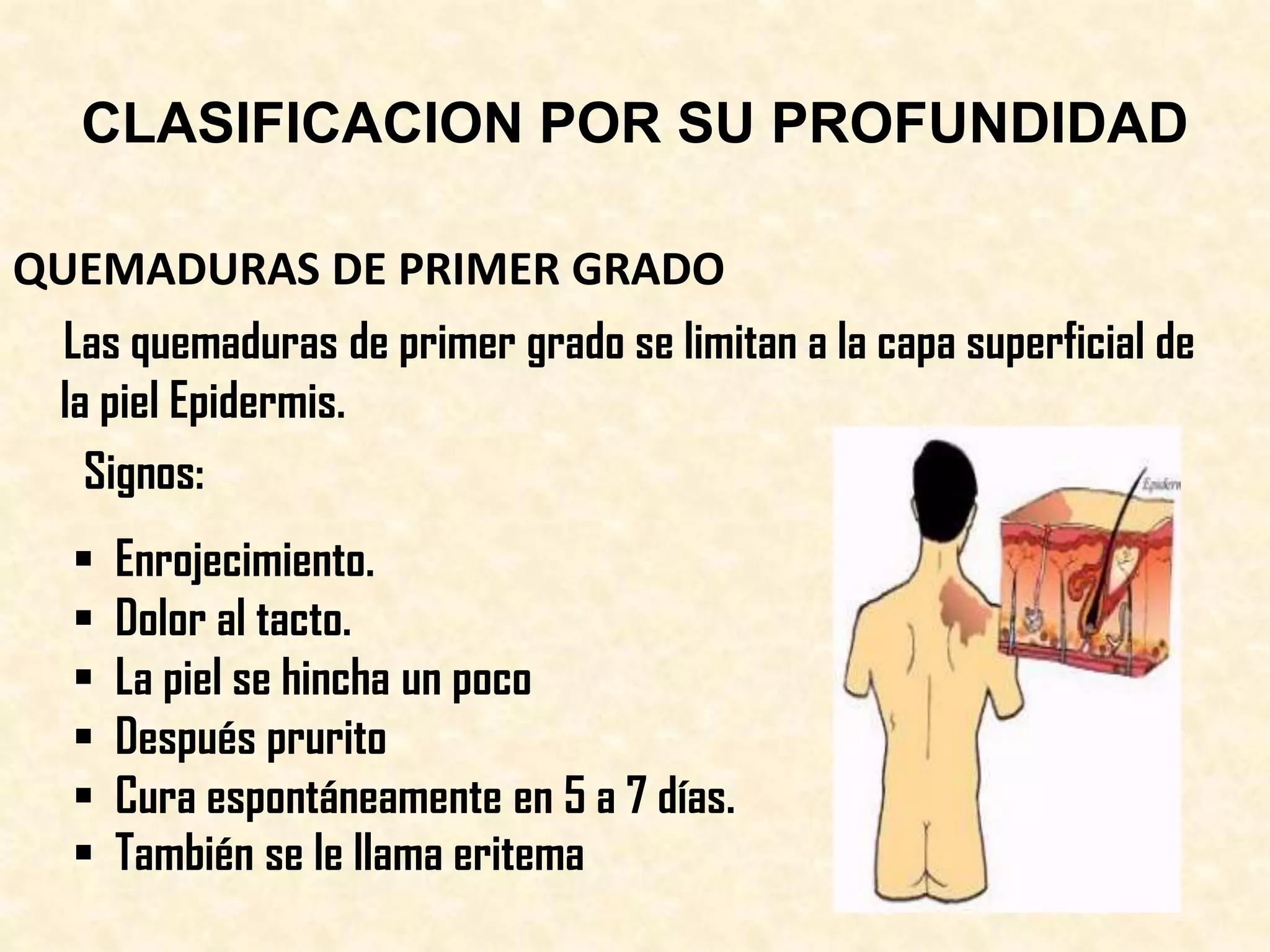 Quemaduras, clasificación y cuidados de enfermería | PPT