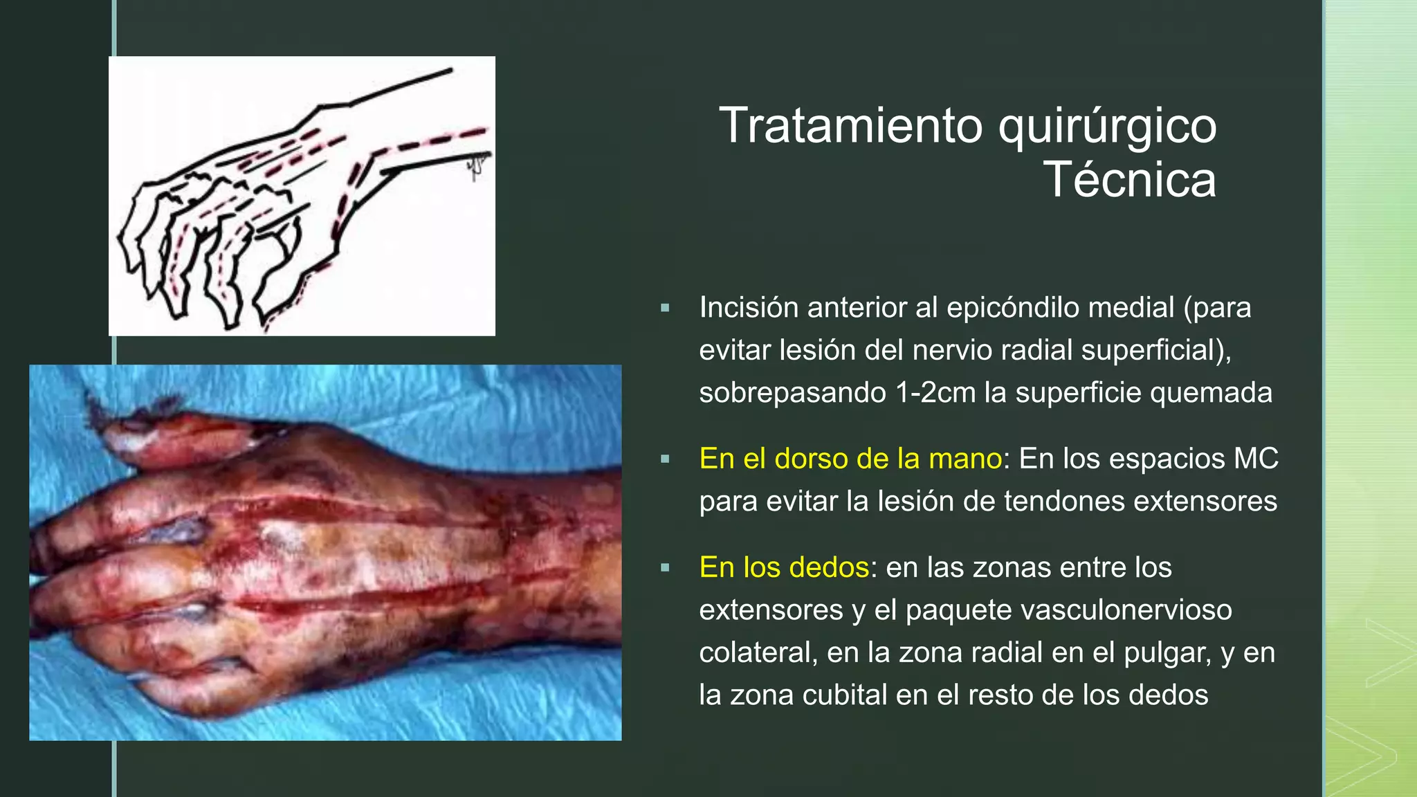 Quemaduras faciales y de manos | PPT