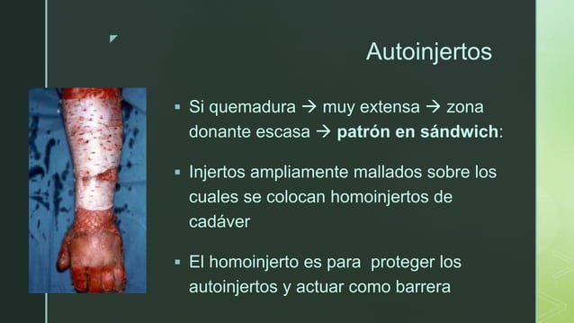 Quemaduras faciales y de manos | PPT