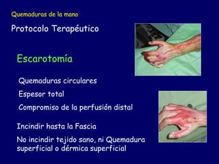Escarotomía