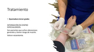 Quemadurass clasificación y tratamiento | PPTX
